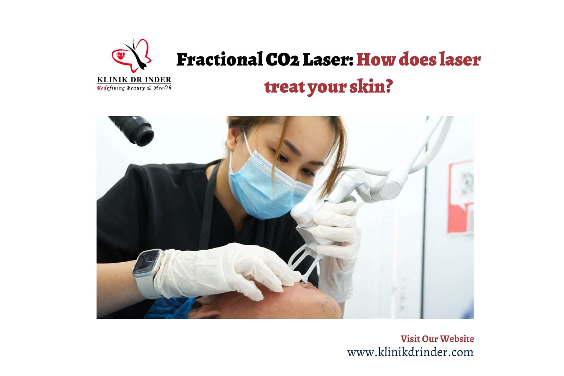 Fractional CO2 Laser: How does laser treat your skin?