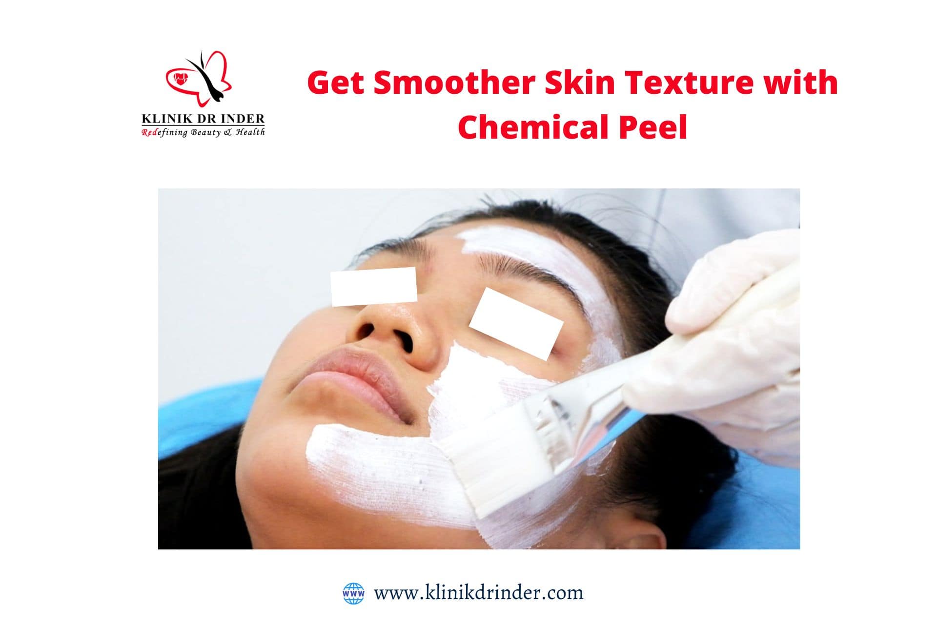 Get Smoother Skin Texture with Chemical Peel-Klinik Dr Inder