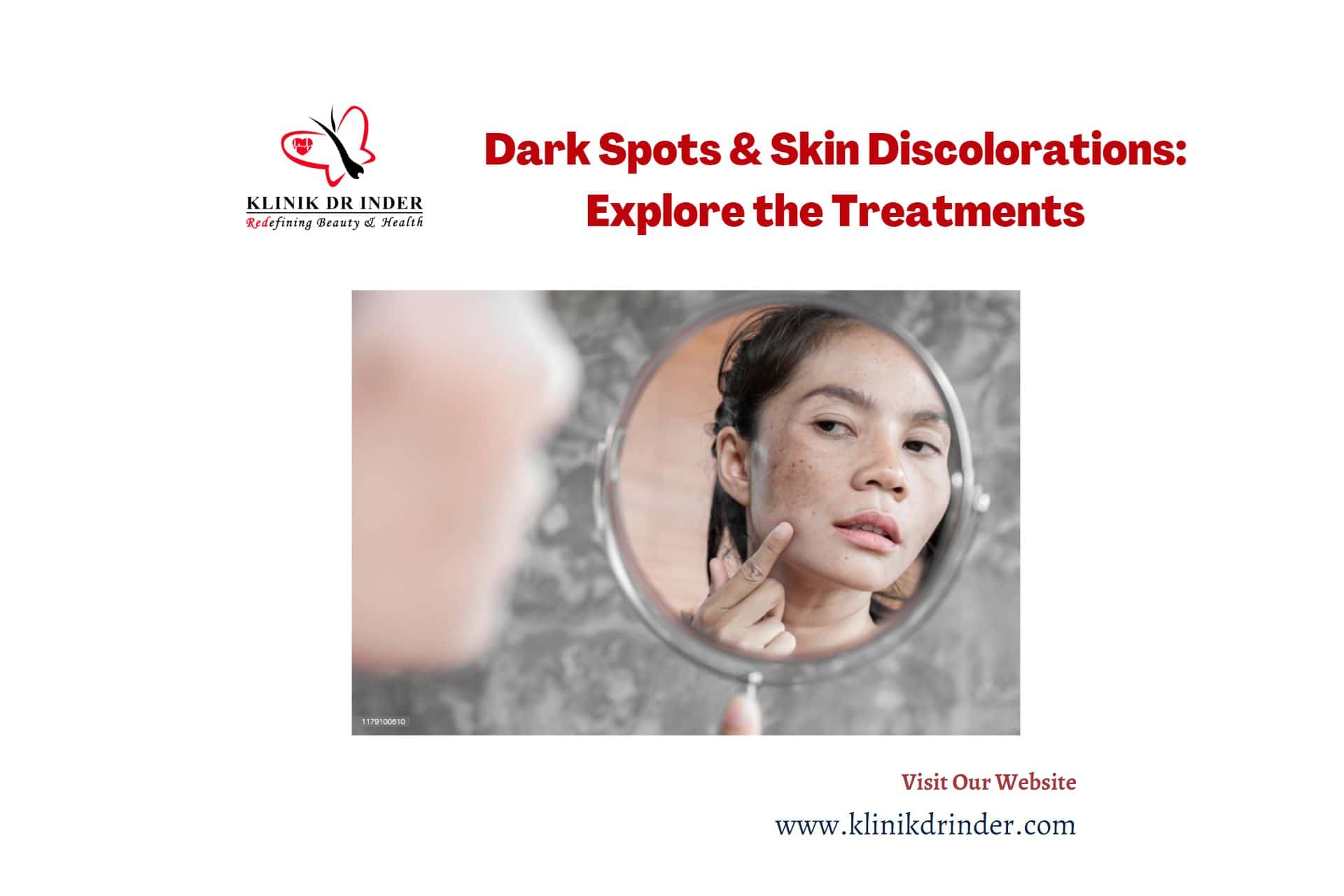 Dark Spots & Skin Discolorations: Explore the Treatments