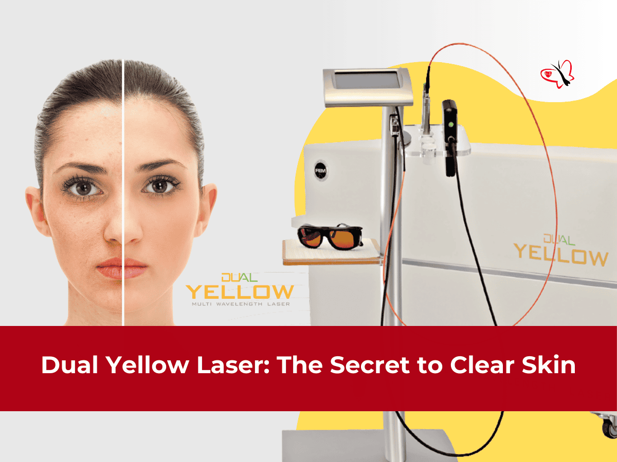 Dual Yellow Laser: The Secret to Clear Skin